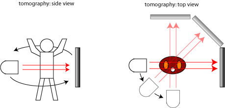 The discovery, rediscovery, and re-rediscovery of computed tomography ...
